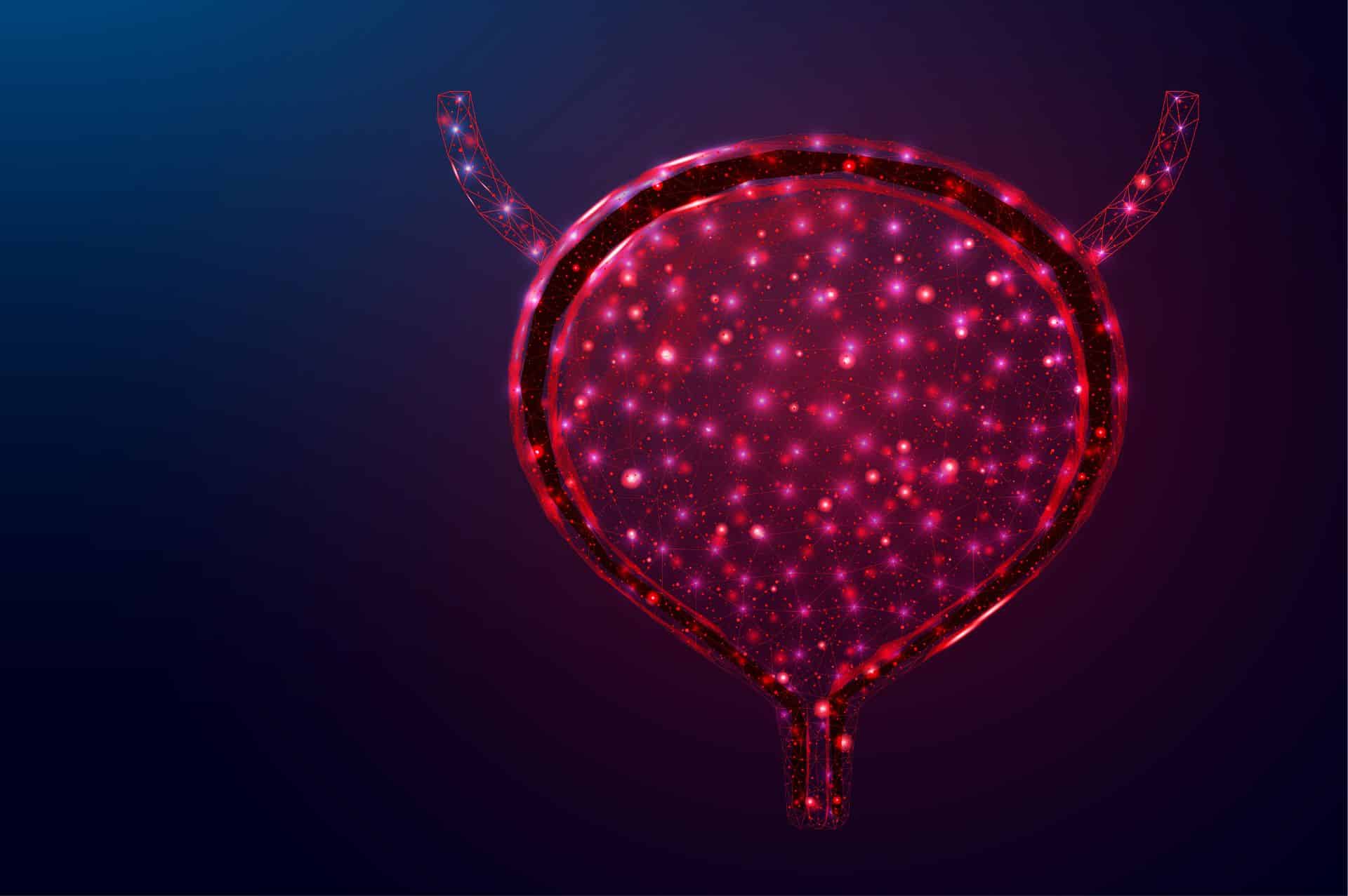 Καρκίνος Ουροδόχου Κύστης | Dr. Δ. Καραναστάσης